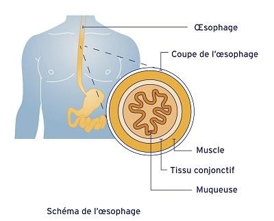 Types de cancer de l’œsophage et anatomie de l'organe - Fondation contre le cancer